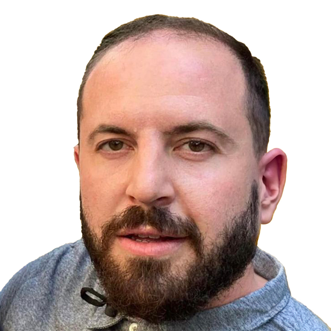 Gallery Hair Transplant Turkey | Turkeyana Clinic